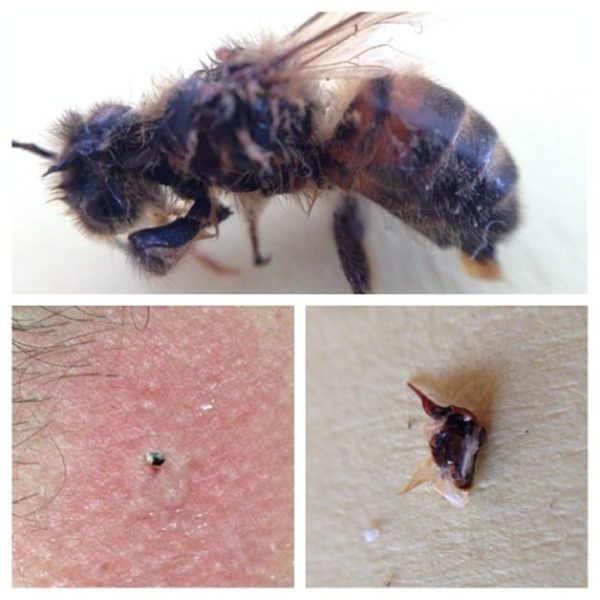 37 Fascinating Bee Facts Everyone Should Know